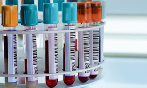 Biochemical analysis — 霈榯生醫 PASS BioMed